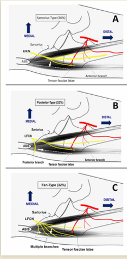 JBJS Editor’s Choice—Prevent Nerve Damage During Anterior Hip ...