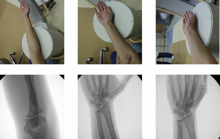 JBJS Editor’s Choice—Anatomy: A Variable Key to Success in Orthopaedics ...