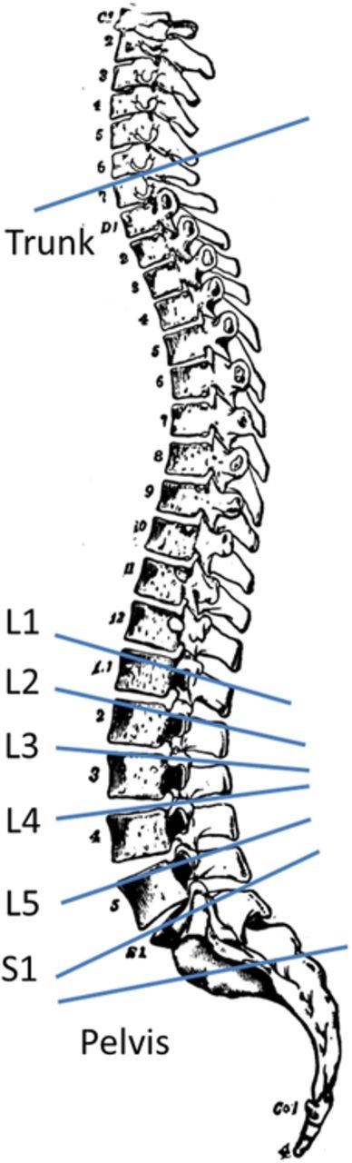 What’s New in Spine Surgery - OrthoBuzz