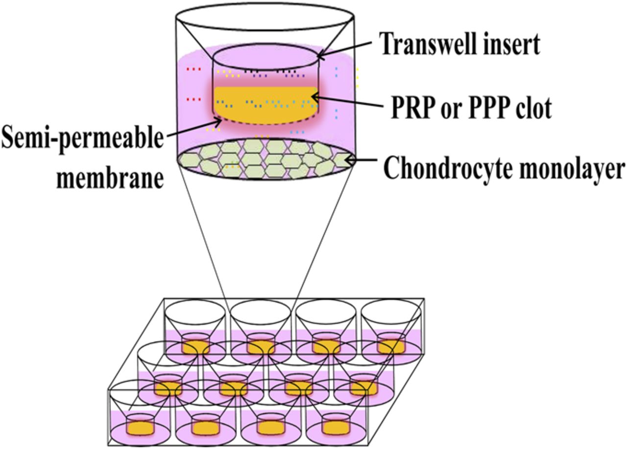 Preparing PRP: More Questions than Answers - OrthoBuzz