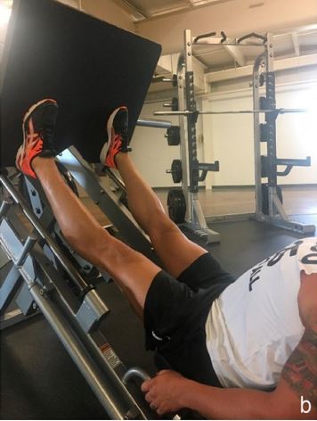 Weight Training-Induced Bilateral Knee Dislocation - OrthoBuzz