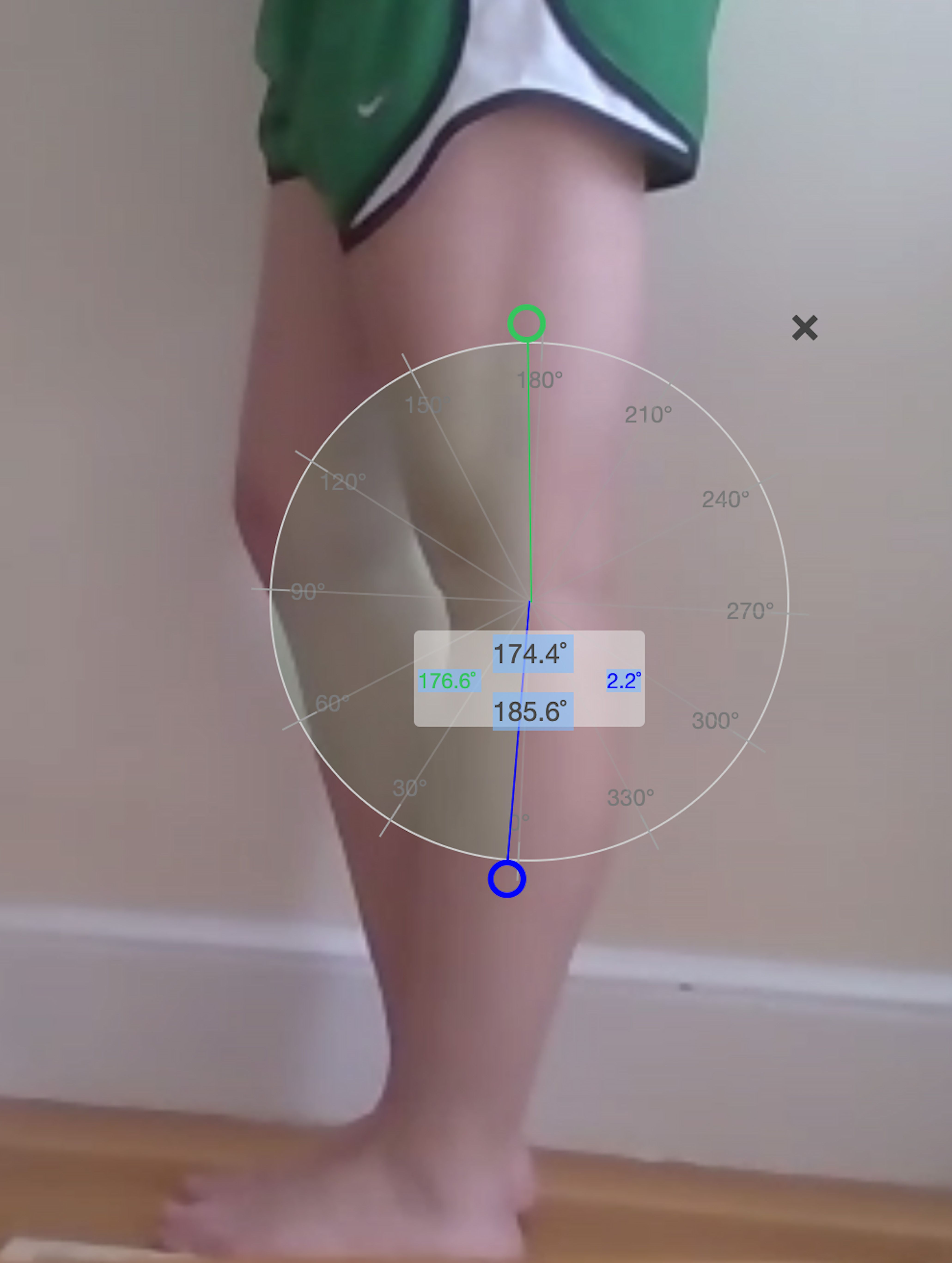 How to Conduct a Virtual Orthopaedic Examination - OrthoBuzz