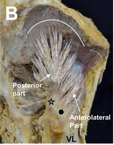 Surgery to Repair the Hip’s 'Rotator Cuff' - OrthoBuzz