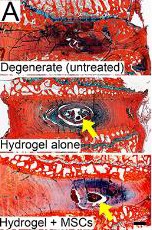 Hydrogel + Stem Cells Improve Disc Conditions in Goats - OrthoBuzz