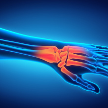 flexor tendon injury Archives - OrthoBuzz