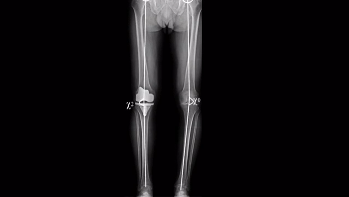 JBJS Essential Surgical Techniques Awards - OrthoBuzz