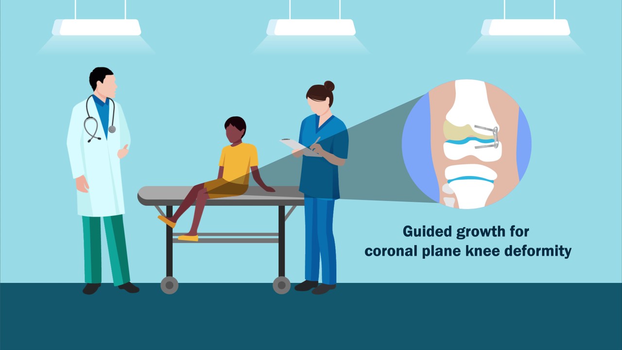 Video Abstract: Transphyseal Screw vs. Plate in Hemiepiphysiodesis for ...